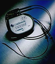 Gastric Neurostimulator Implant | UCSF Department of Surgery